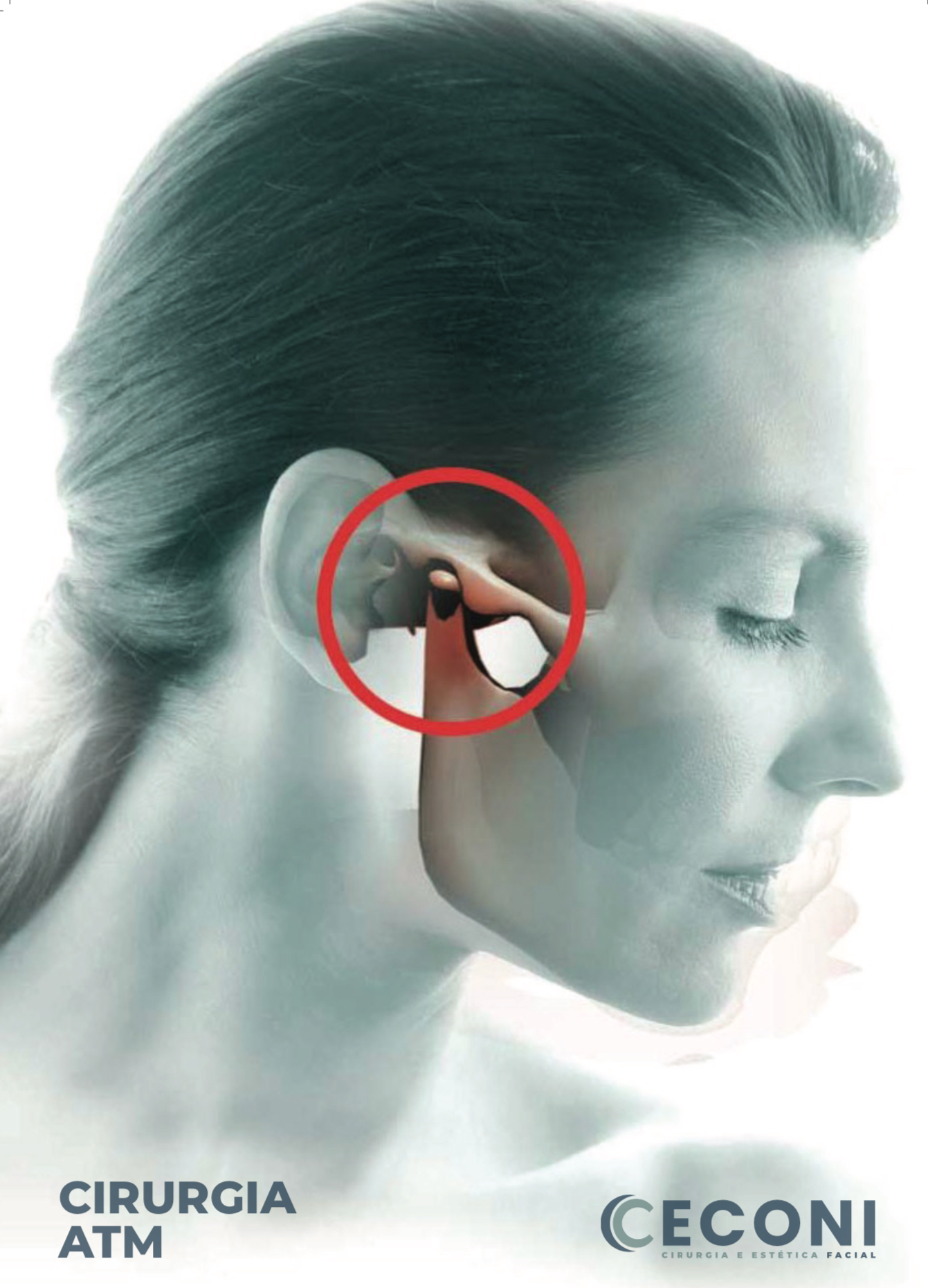 Cirurgia de ATM – Clínica Ceconi